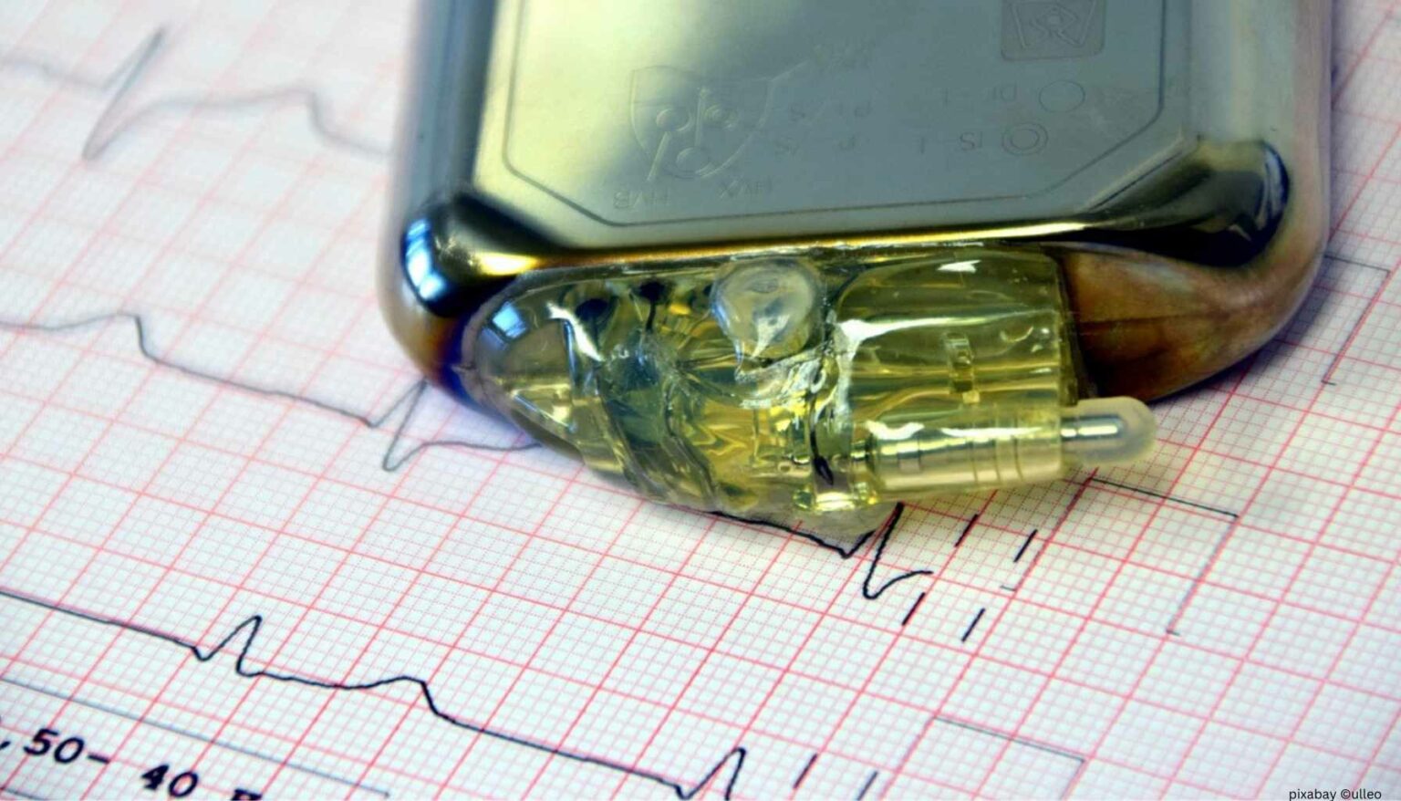 Defibrillator und Herzschrittmacher - was ist der Unterschied?